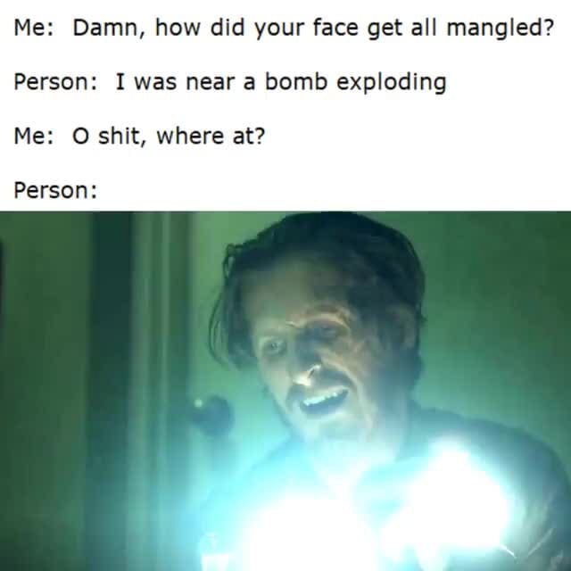 Me: Damn, how did your face get all mangled? Person: I was near a bomb ...