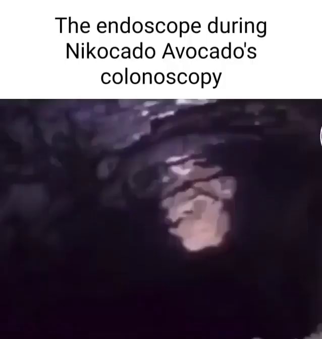 The endoscope during Nikocado Avocado's colonoscopy - iFunny