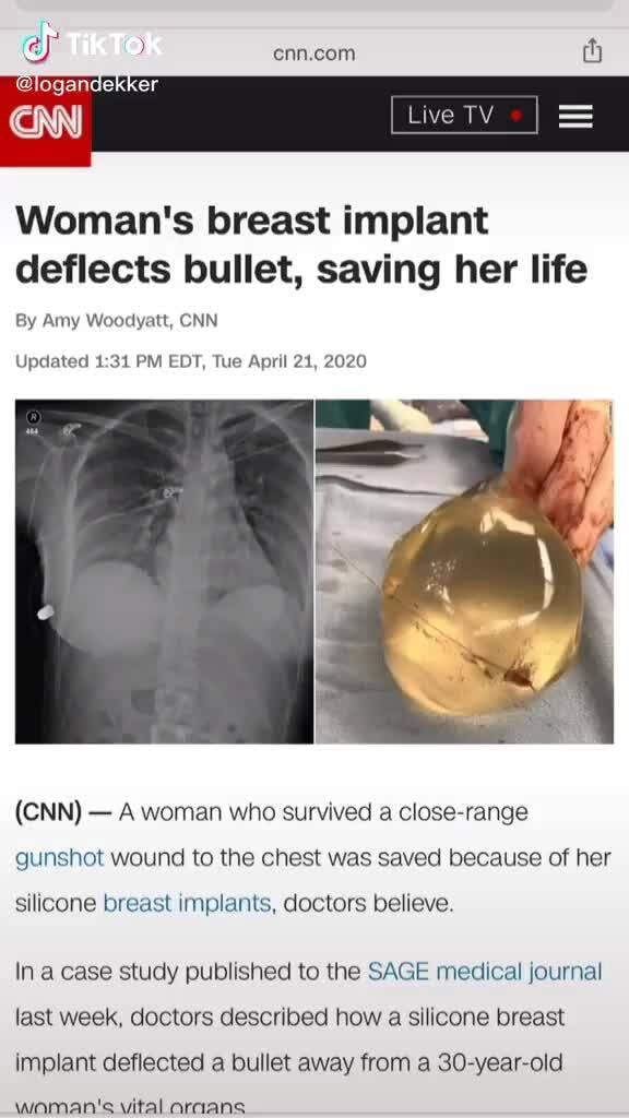 Tiktok Ogandekker Cnn Com Womans Breast Implant Deflects Bullet
