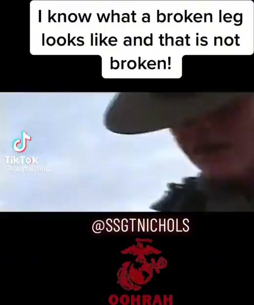 I know what a broken leg looks like and that is not broken ...