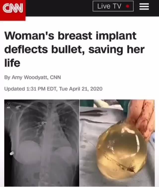 Womans Breast Implant Deflects Bullet Saving Her Life By Amy Woodyatt