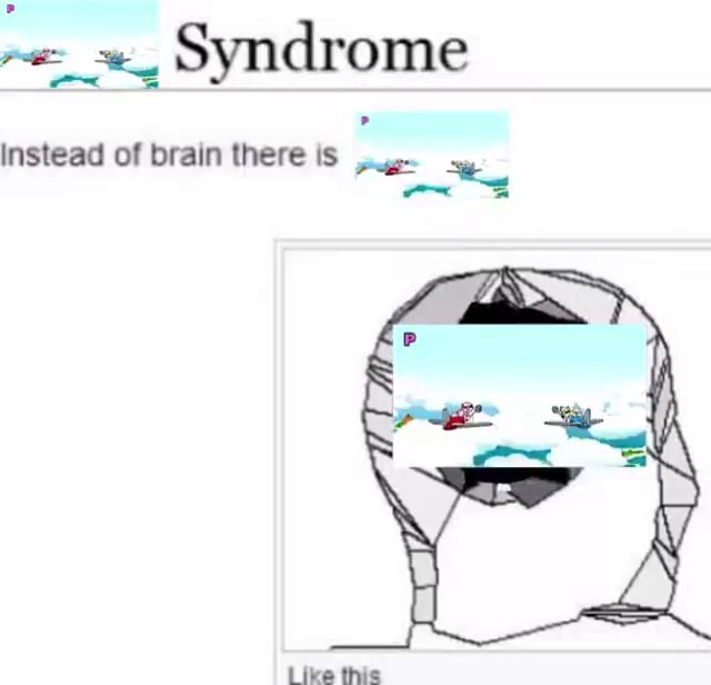 Syndrome instead of brain there is Like this - iFunny