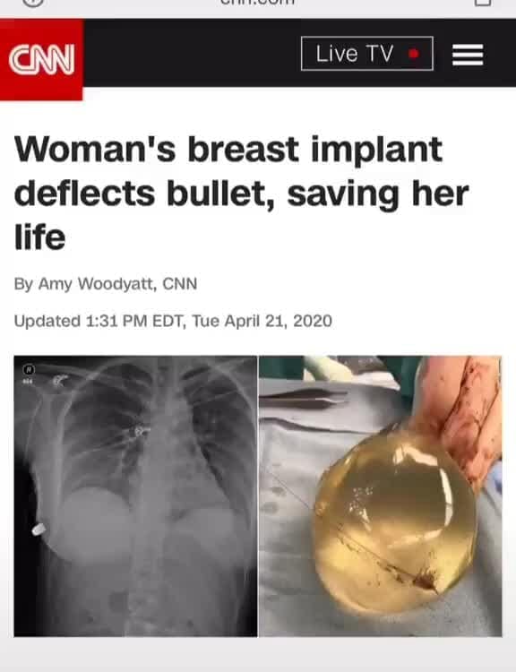 Womans Breast Implant Deflects Bullet Saving Her Life By Amy Woodyatt
