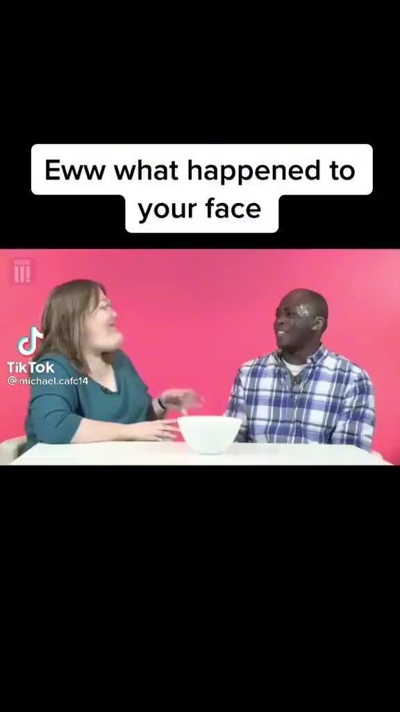 Eww what happened to your face - iFunny